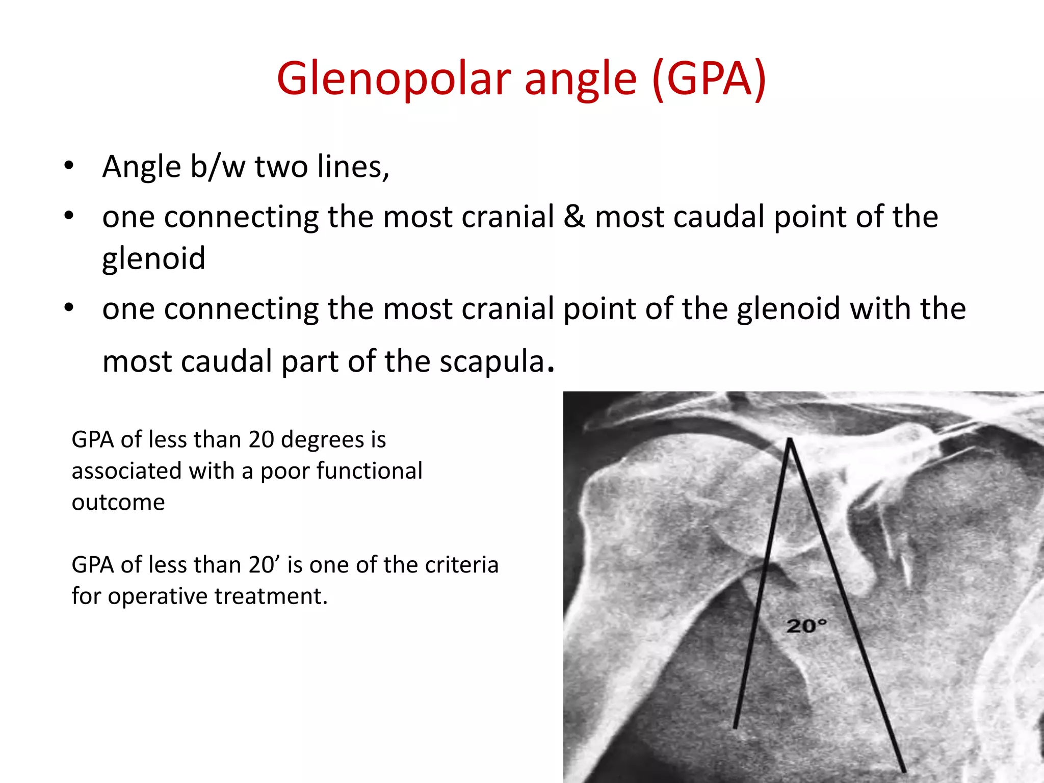 Clavicle and scapular fracture | PPTX