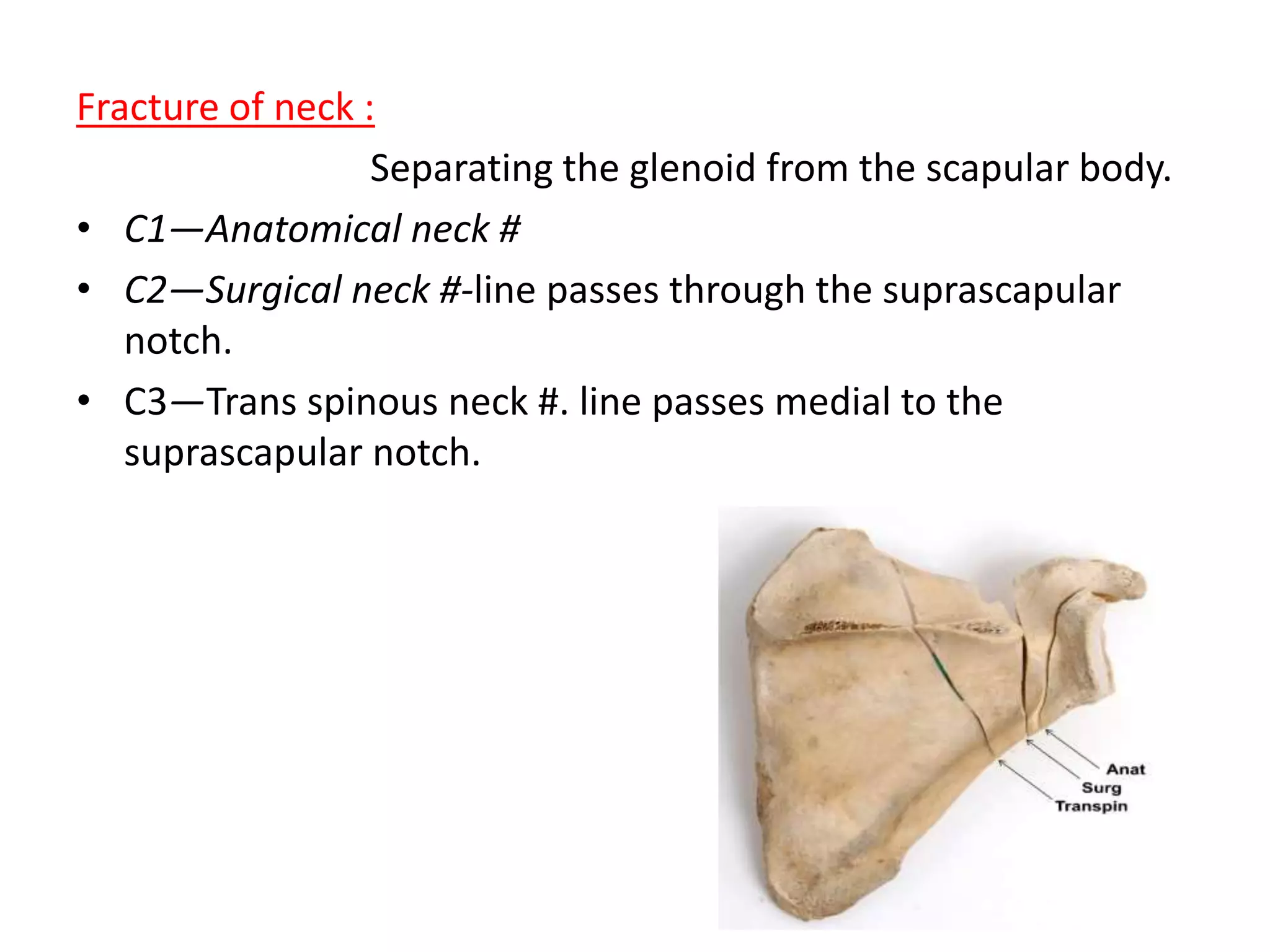 Clavicle and scapular fracture | PPTX