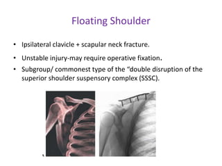 Clavicle and scapular fracture | PPTX