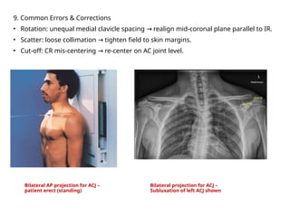 CLAVICLE, ACJ and SCJ radiographic technique.pptx
