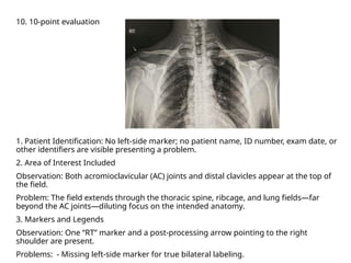 CLAVICLE, ACJ and SCJ radiographic technique.pptx