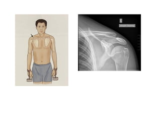 CLAVICLE, ACJ and SCJ radiographic technique.pptx