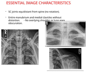 CLAVICLE, ACJ and SCJ radiographic technique.pptx