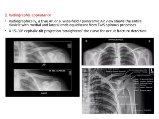 CLAVICLE, ACJ and SCJ radiographic technique.pptx