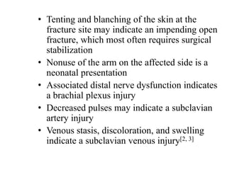 Clavicle fracture | PPT