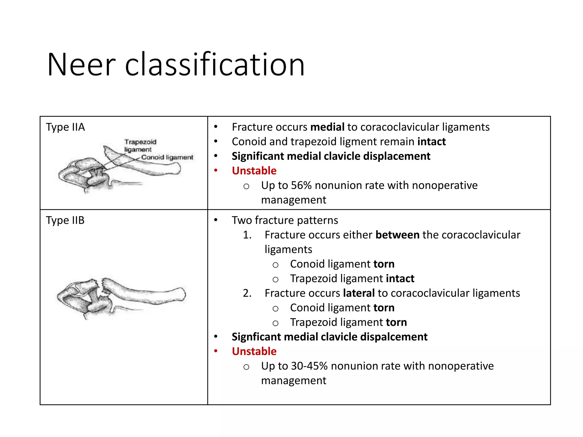 Clavicle fracture | PPTX