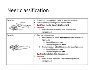 Clavicle fracture | PPTX