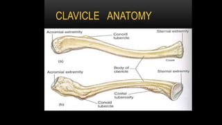 CLAVICLE FRACTURE clinical features and management | PPTX