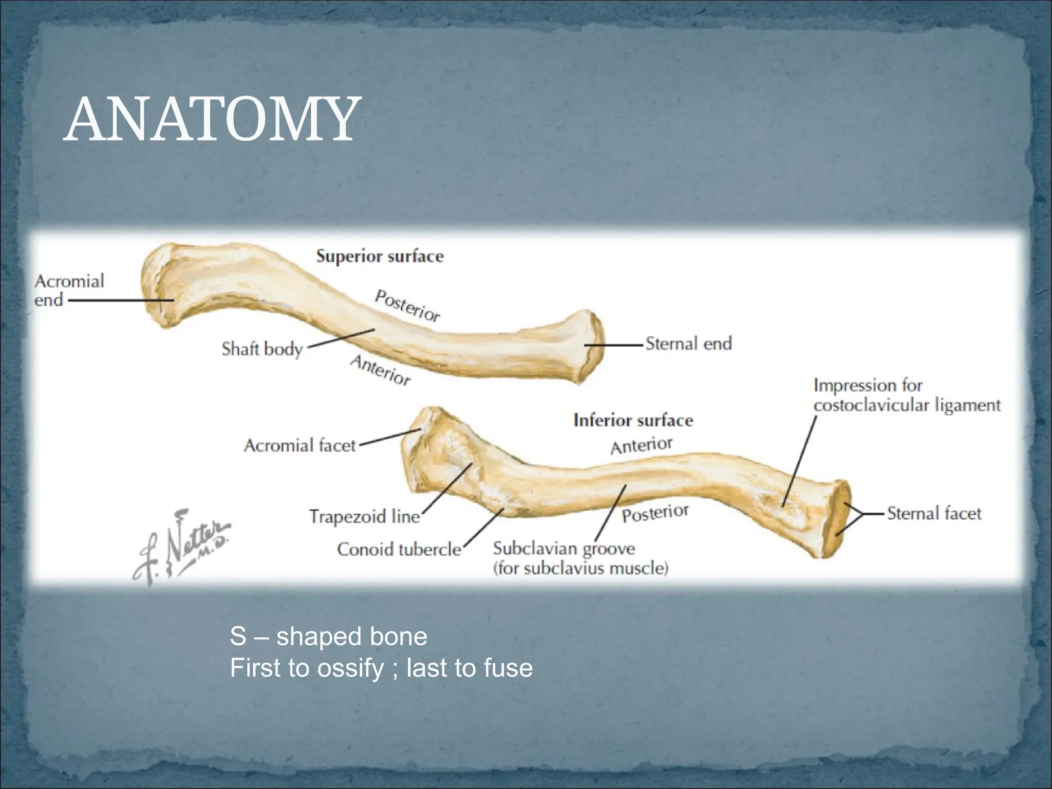 CLAVICLE FRACTURE - Etiopathogenesis , clinical features and management.ppt