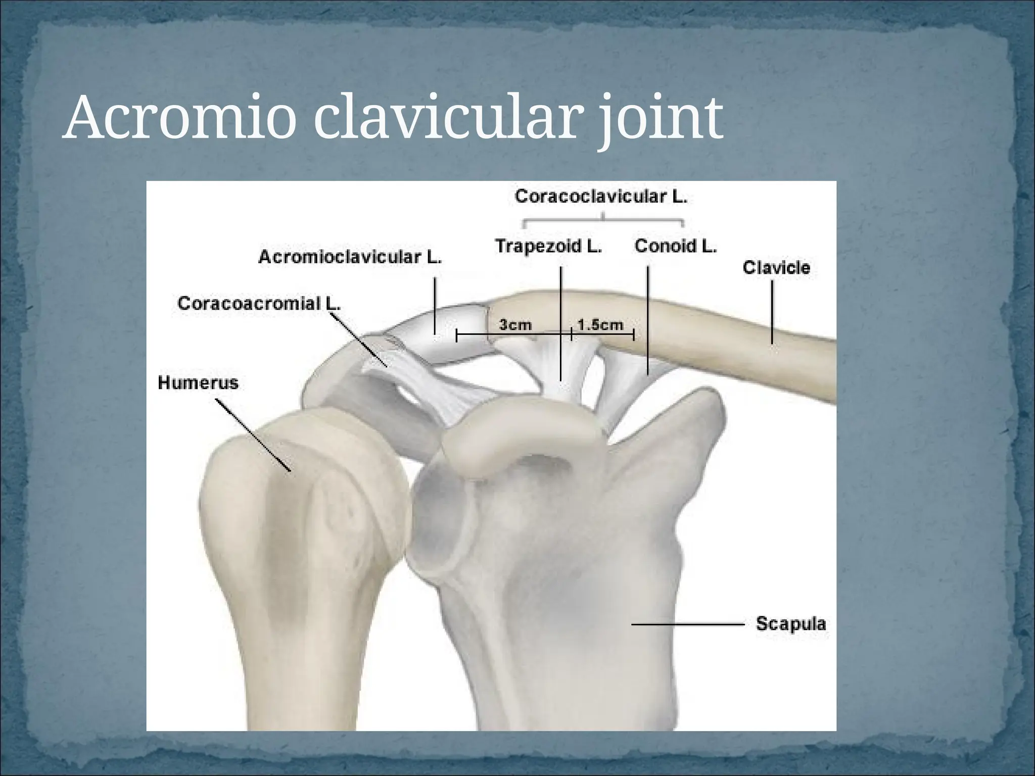 CLAVICLE FRACTURE - Etiopathogenesis , clinical features and management.ppt