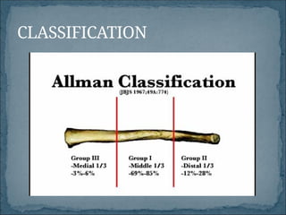 CLAVICLE FRACTURE - Etiopathogenesis , clinical features and management.ppt