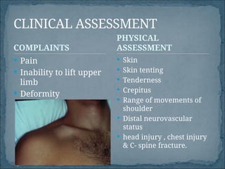 CLAVICLE FRACTURE - Etiopathogenesis , clinical features and management.ppt