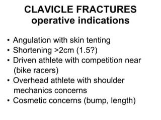 Clavicle fractures | PPT