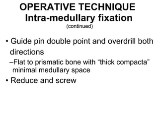 Clavicle fractures | PPT