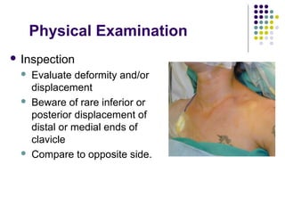 Clavicle fractures | PPT