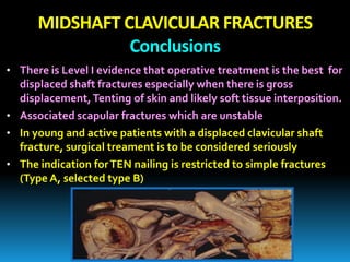 Clavicle fractures | PDF