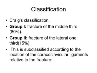 Clavicle fractures | PPTX