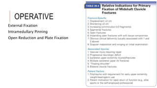 Clavicle fractures (Fraktur Pada Clavicula) | PPTX