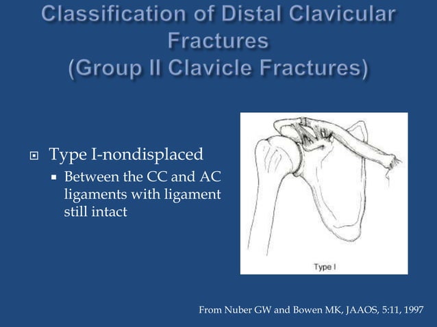 Clavicle fractures&acromio clavicular joint injuries | PPTX | Death ...
