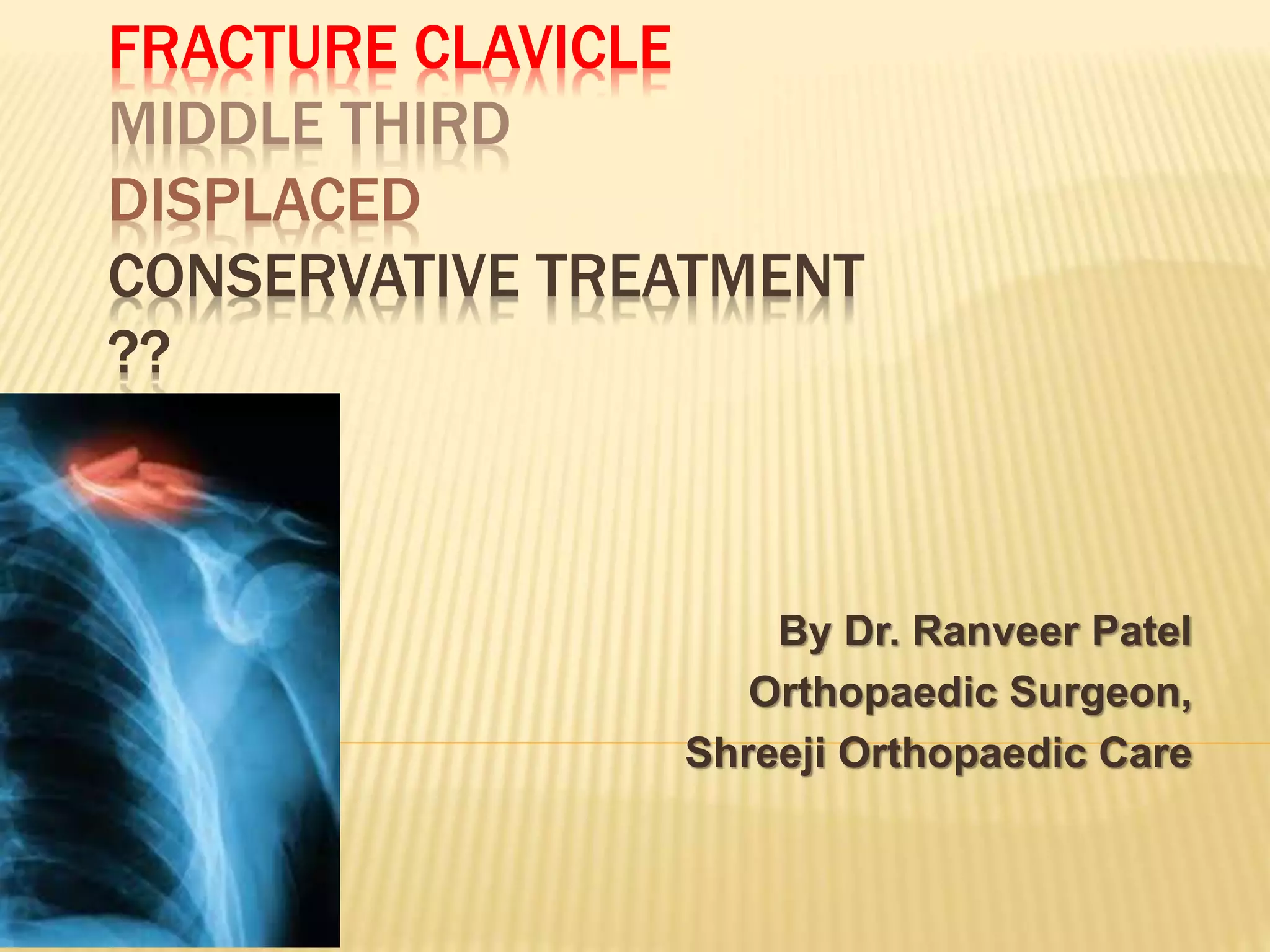 Clavicle Fracture management - what to do | PPT