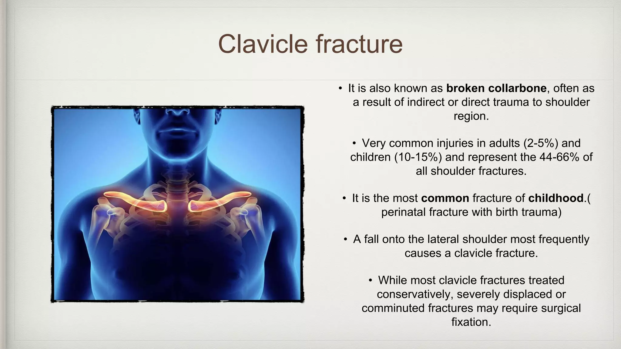 Clavicular fracture .pptx