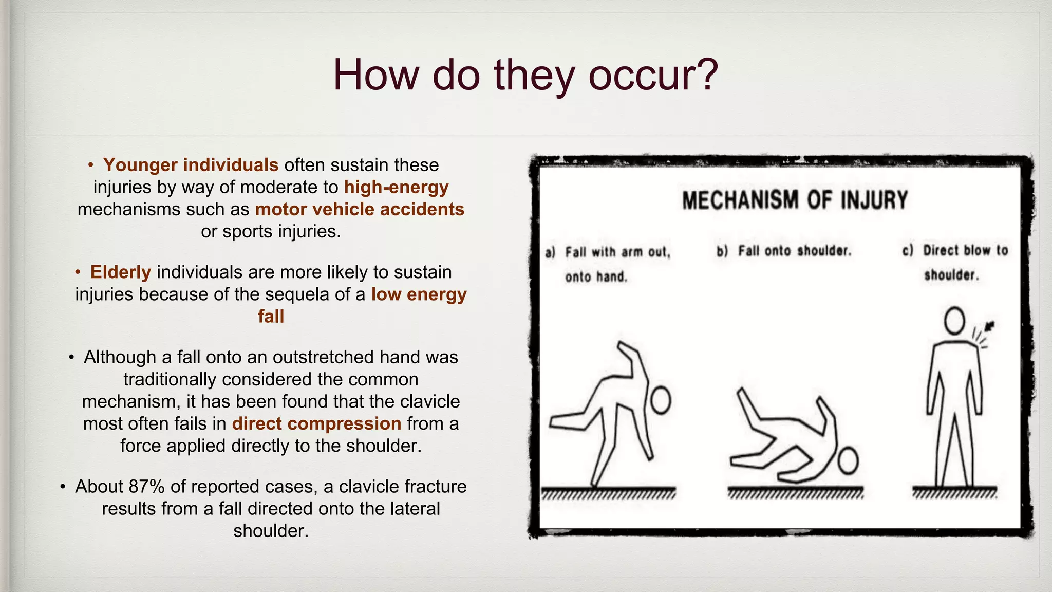 Clavicular fracture .pptx