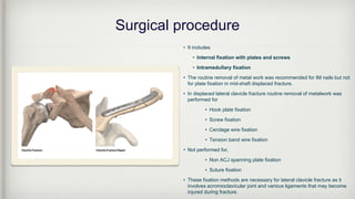 Clavicular fracture .pptx