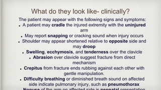 Clavicular fracture .pptx