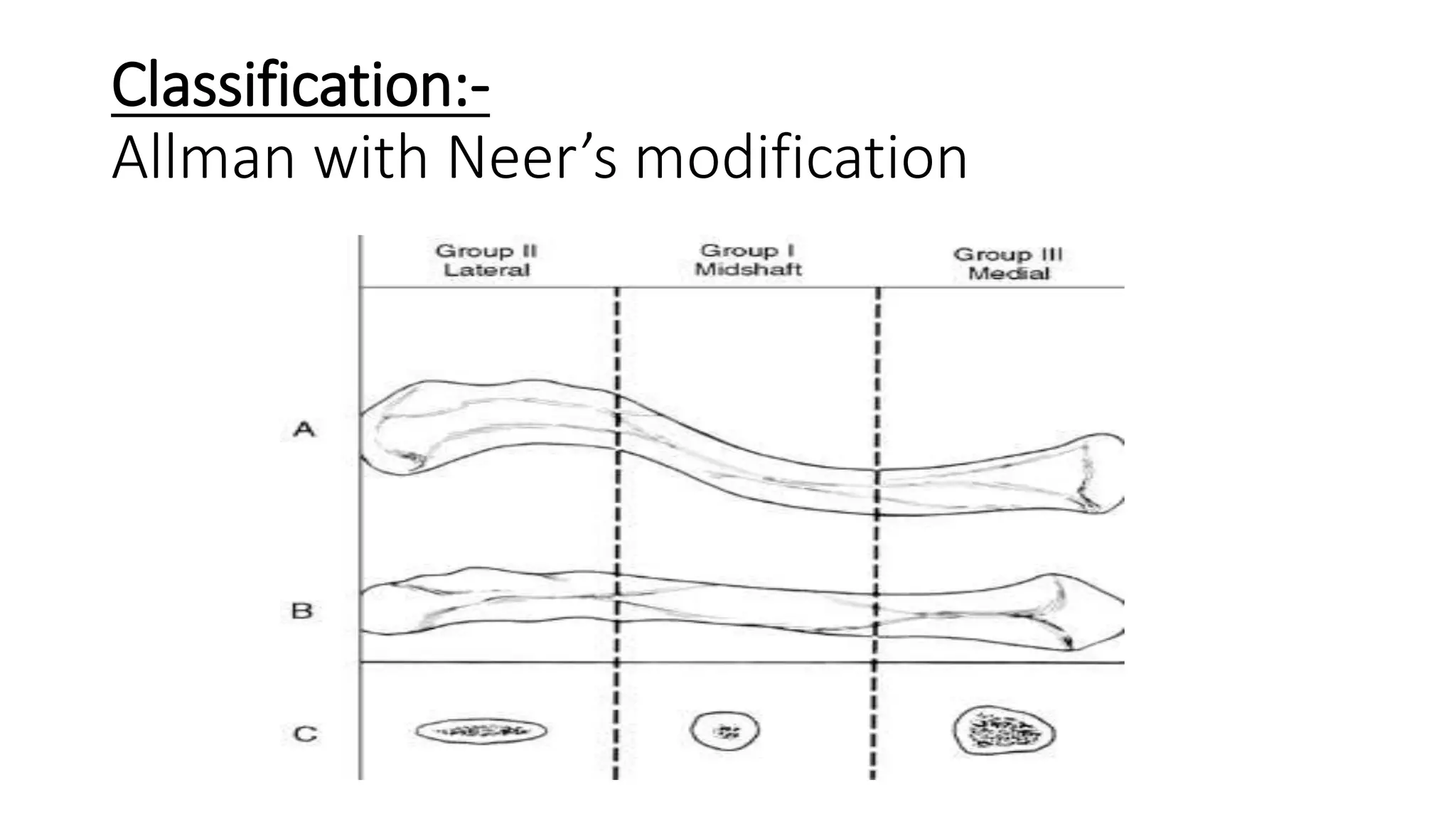 Clavicular fracture & acj injury | PPTX