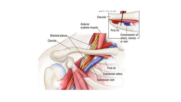 Clavicular fracture & acj injury | PPTX