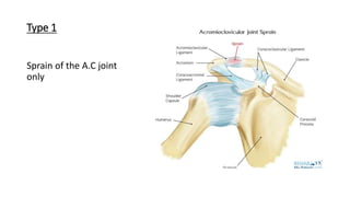 Clavicular fracture & acj injury | PPTX