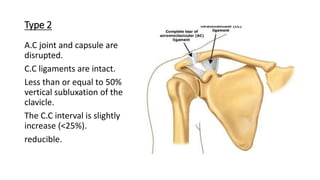 Clavicular fracture & acj injury | PPTX
