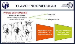 Clavos endomedulares | PPTX