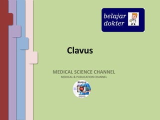 Clavushuhjnjdjdjssvebdbdvtdhfsbfebgshfsvrbfabthtebrwj.pdf