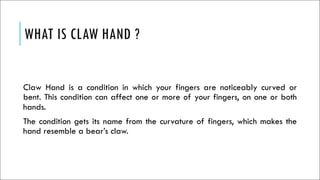 Claw Hand | PPT