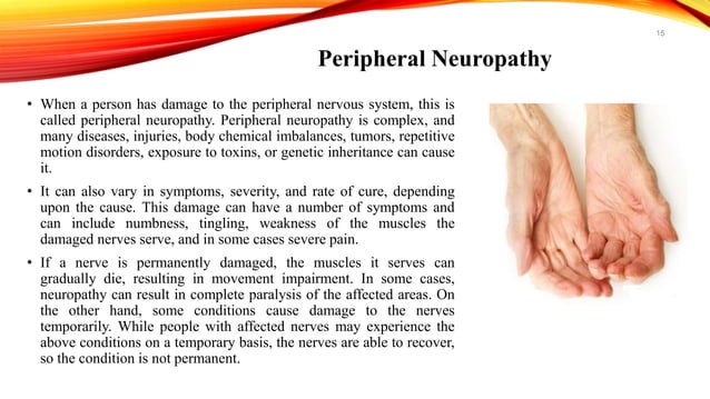 Claw Hand,Definition,Causes,Types,Symptoms and Management | PPTX ...