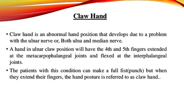 Claw hand,causes,types,symptoms,management