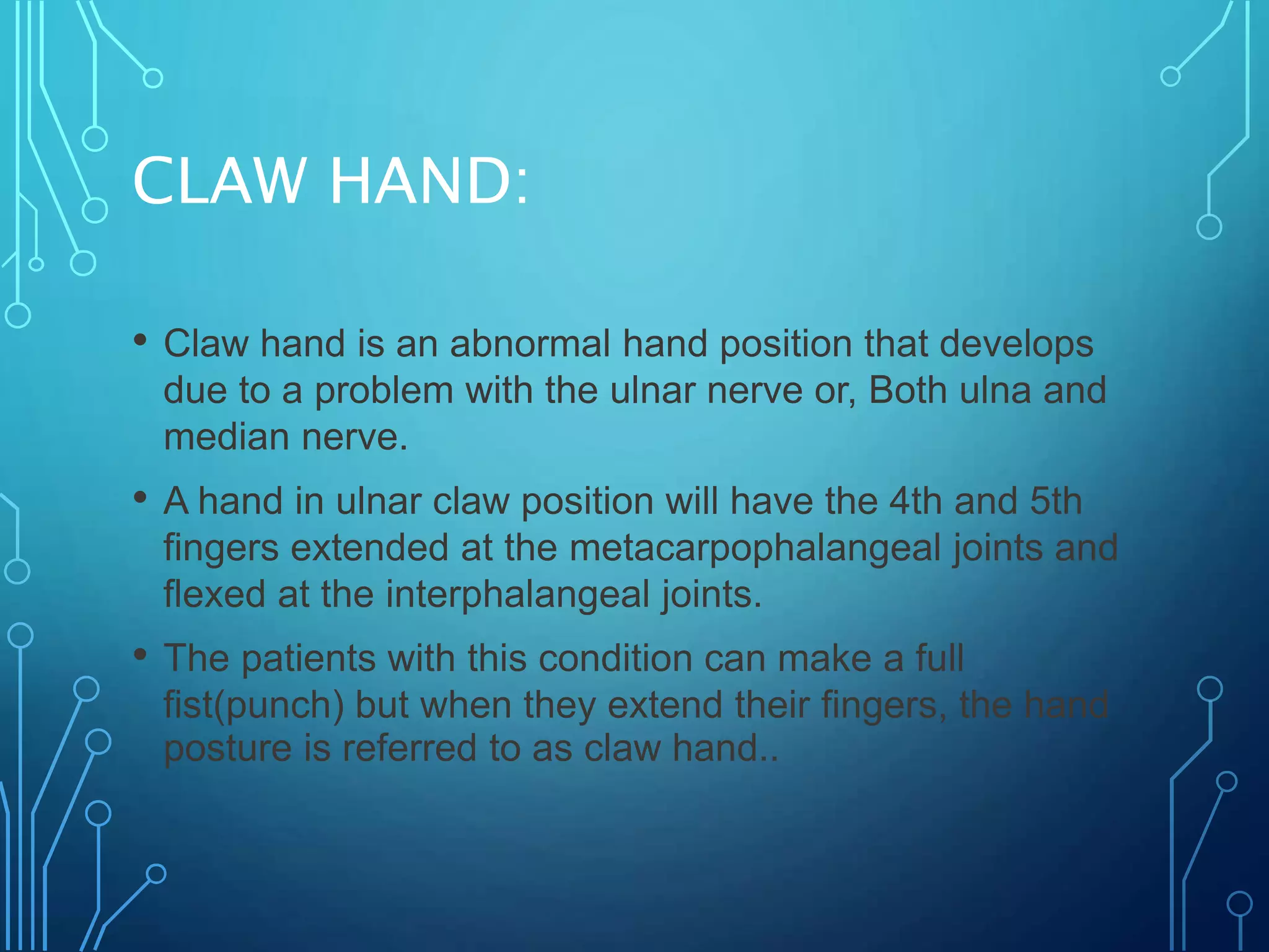 CLAW HAND.pptx