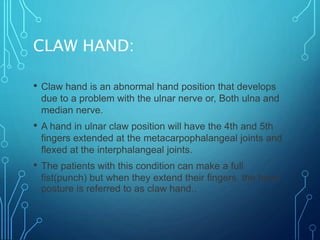 CLAW HAND.pptx