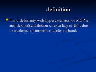 CLAW HAND ulnar claw hand etiology etc.ppt