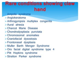 Claw hand dr akbar | PPT