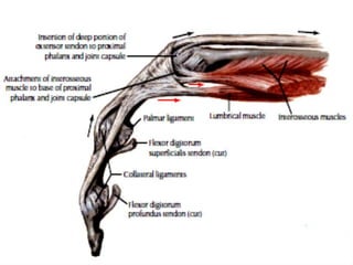 Claw hand dr akbar | PPT