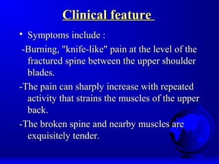 Clay shoveler's fracture | PPT