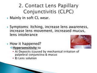 Complications of Contact Lenses | PPTX