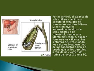 Cálculos biliares | PPTX
