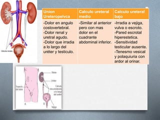 Cálculos renales y ureterales salazar cerritos gonzalez | PPTX