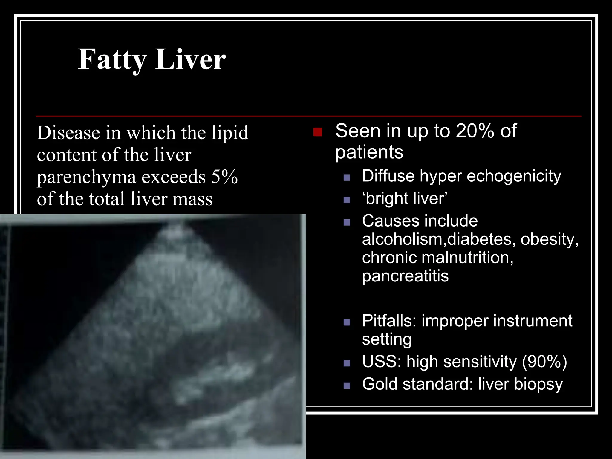Chronic Liver Disease By Dr. Ememena for Medical Students | PPT