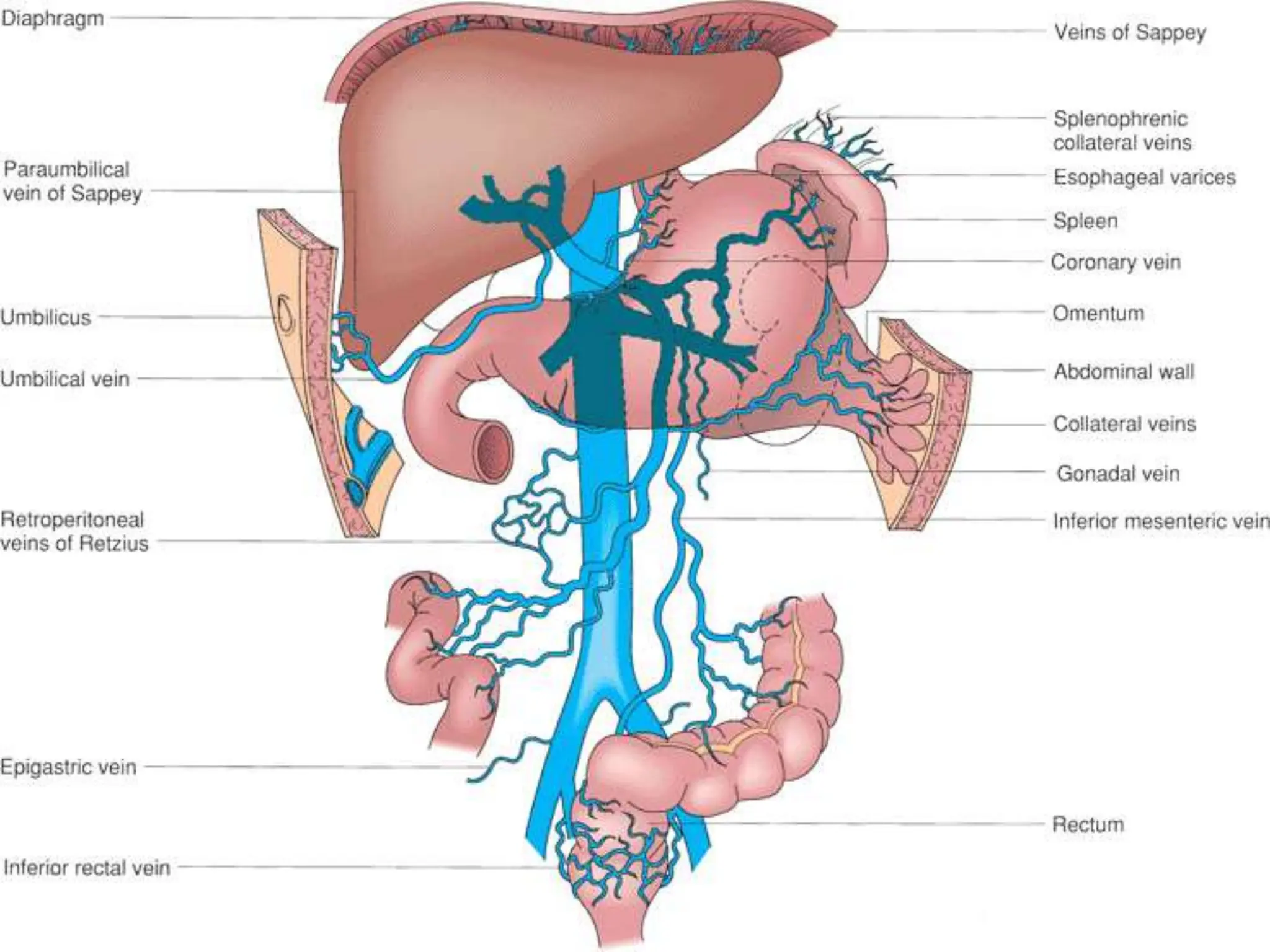 Chronic Liver Disease By Dr. Ememena for Medical Students | PPT