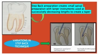 Cleaning and shaping of Root canal system | PPTX