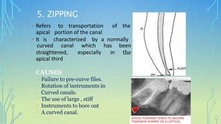 Cleaning and shaping of root canal systems | PPTX